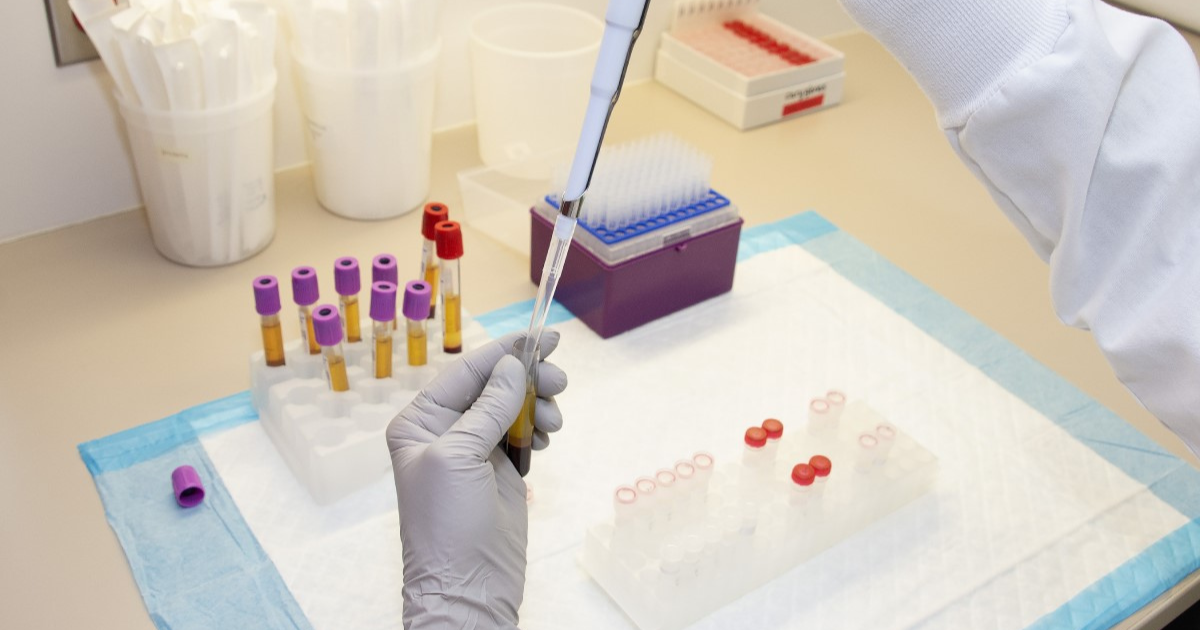 Protocole novateur pour prévoir la récidive du cancer du poumon